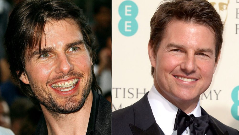 Tom Cruise sorprende con su ‘nuevo’ y rejuvenecido rostro