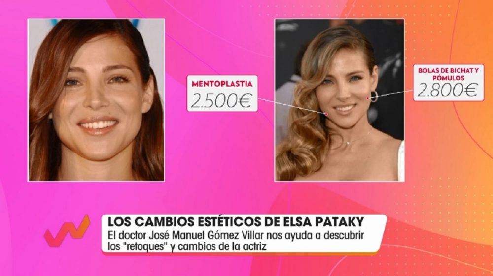 Elsa Pataky: todo sobre las operaciones que se ha hecho y lo que le ha ...
