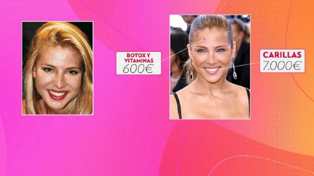 Elsa Pataky: todo sobre las operaciones que se ha hecho y lo que le ha ...